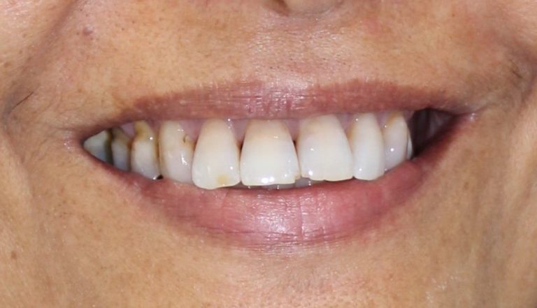 Cosmetic Dentistry / Makeovers - Northland Prosthodontics - Northland ...