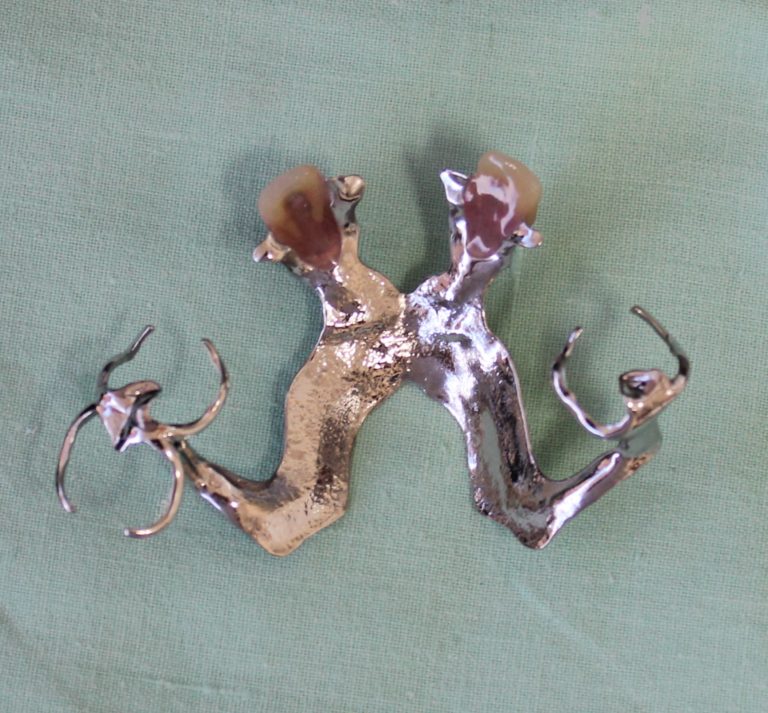 Partial Dentures (plates) - Northland Prosthodontics - Northland ...