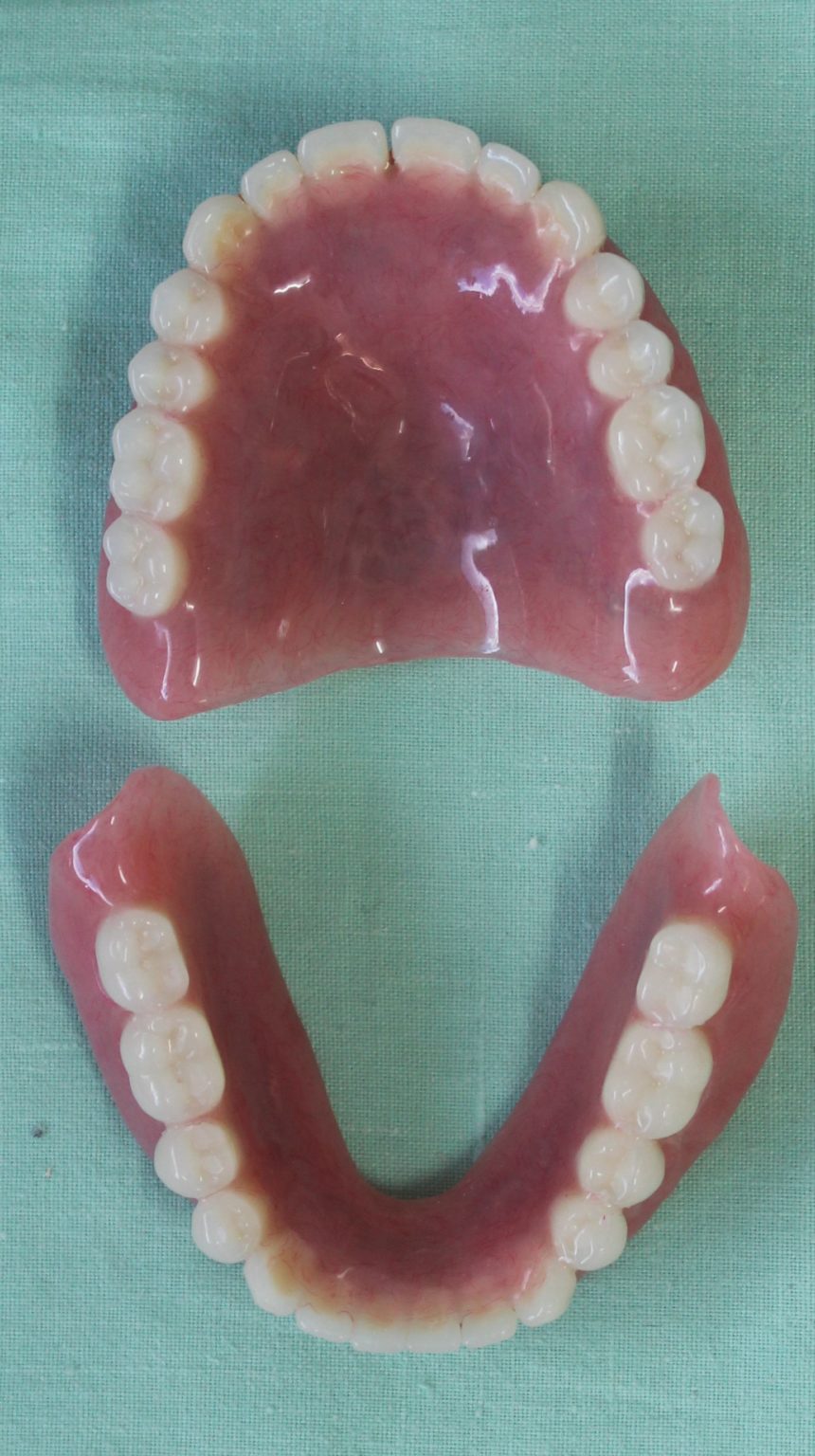 Complete Dentures - Northland Prosthodontics - Northland Denture ...