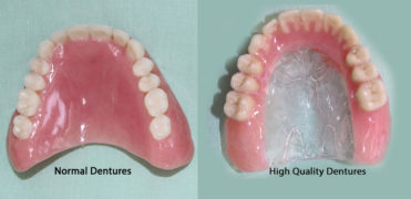 Complete Dentures - Northland Prosthodontics - Northland Denture ...