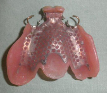 Partial Dentures (plates)